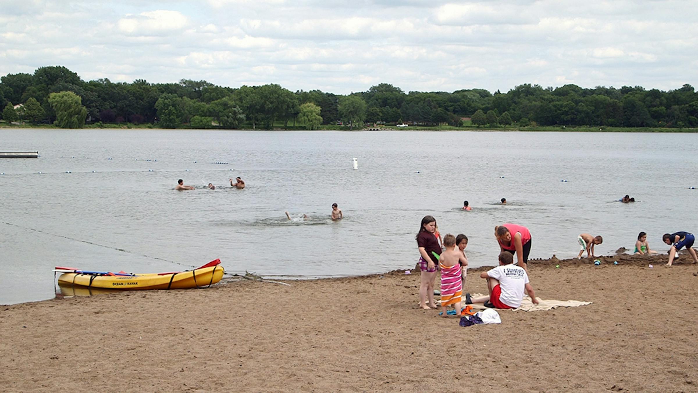 Rare parasite threat grows with third Minnesota case